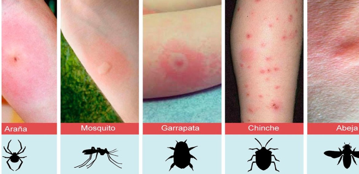 Este verano defiendete de los insectos